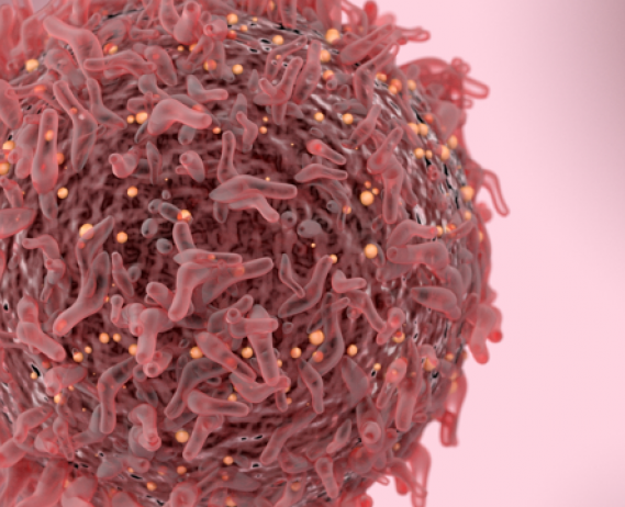 Recommendations For Myeloma Patients Intl Myeloma Fn